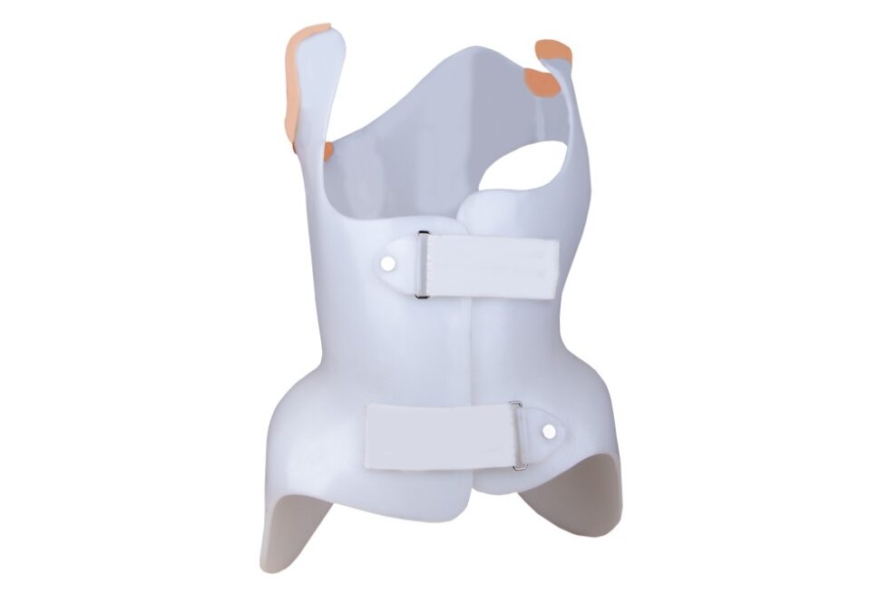 Corset orthopédique : sur mesure, scoliose et lombaire - syringomyelie.fr
