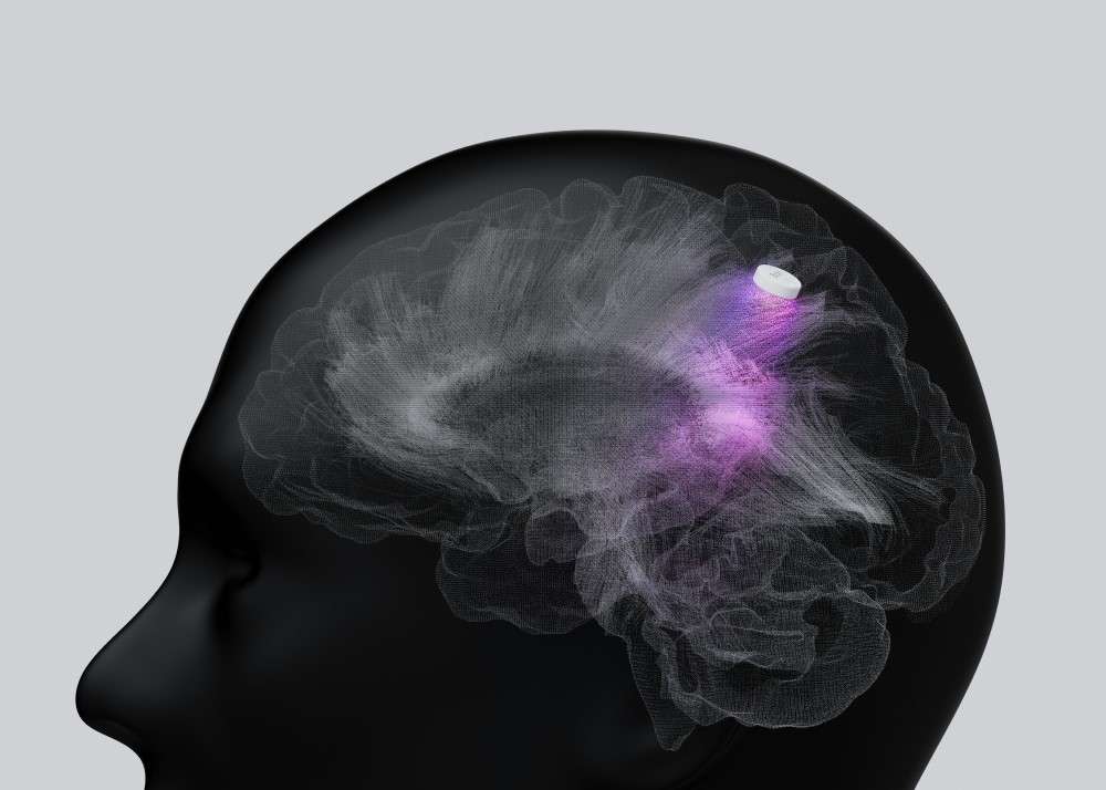 Peut-on vivre longtemps avec une tumeur au cerveau ? - syringomyelie.fr